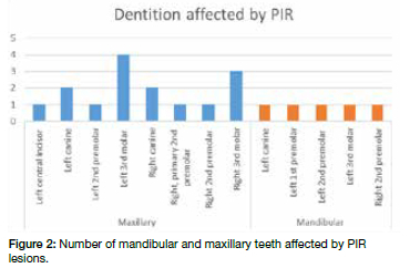 Classification of cases of pre-eruptive intra-coronal resorption