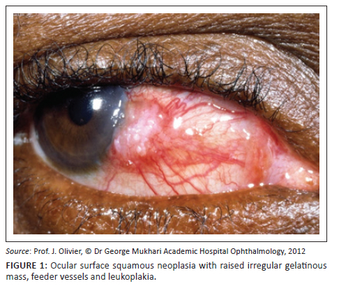 The critical role of primary care clinicians in the early detection of ...