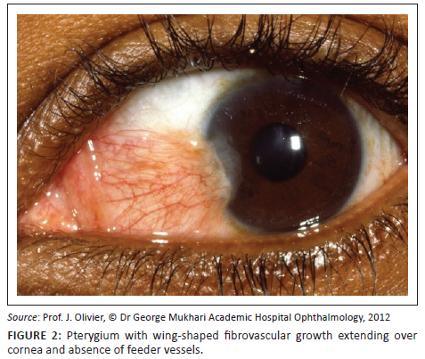 The critical role of primary care clinicians in the early detection of ...