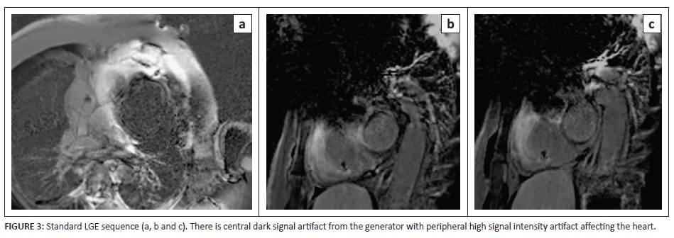 Imaging of patients with implanted devices and arrhythmia